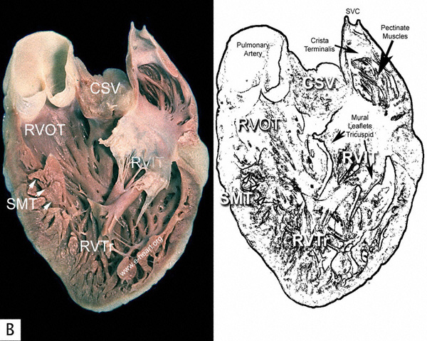 e-heart.org Cardiovascular Pathology Home Page