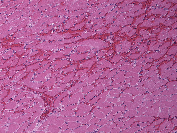 e-heart.org Cardiovascular Pathology Home Page