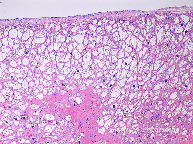 e-heart.org Cardiovascular Pathology Home Page