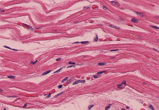 e-heart.org Cardiovascular Pathology Home Page