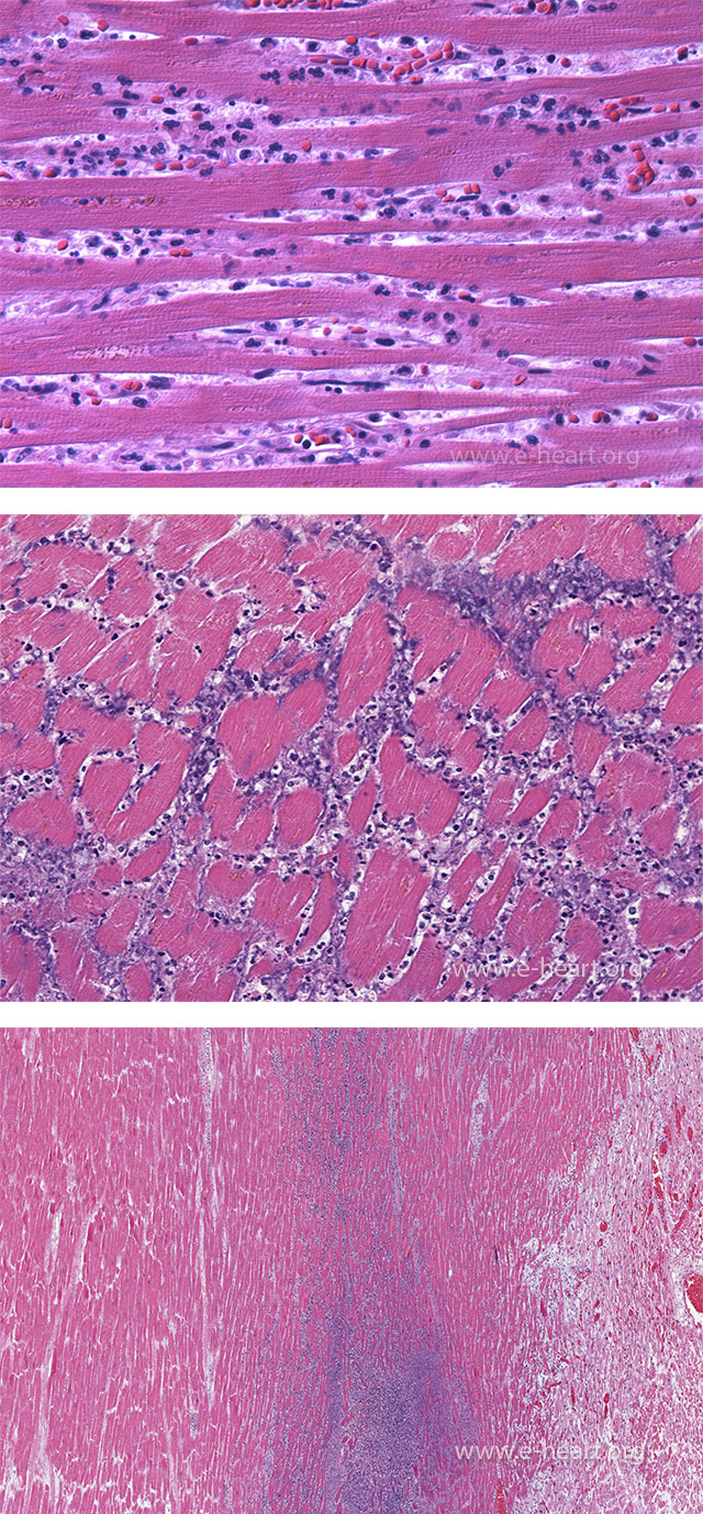 e-heart.org Cardiovascular Pathology Home Page