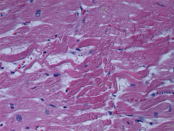 e-heart.org Cardiovascular Pathology Home Page