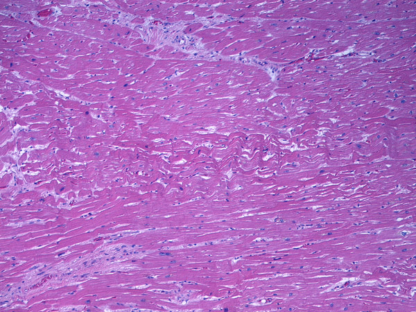 e-heart.org Cardiovascular Pathology Home Page