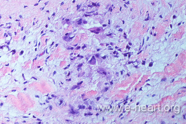 e-heart.org Cardiovascular Pathology Home Page