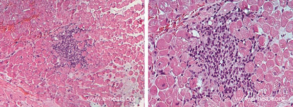 e-heart.org Cardiovascular Pathology Home Page