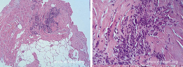 e-heart.org Cardiovascular Pathology Home Page