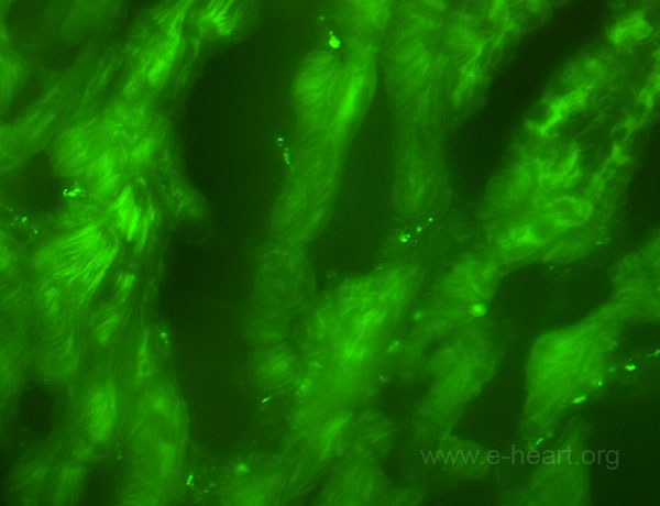 e-heart.org Cardiovascular Pathology Home Page