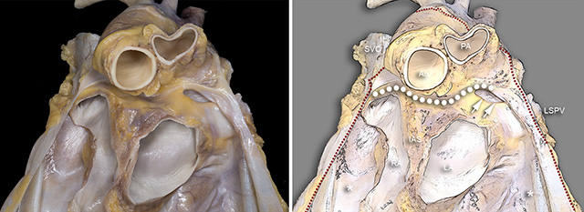 e-heart.org Cardiovascular Pathology Home Page