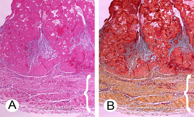 Pericardium Histology