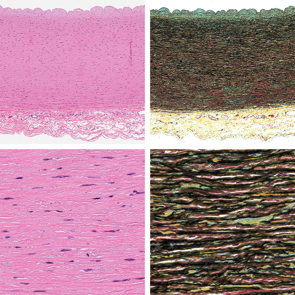 e-heart.org Cardiovascular Pathology Home Page